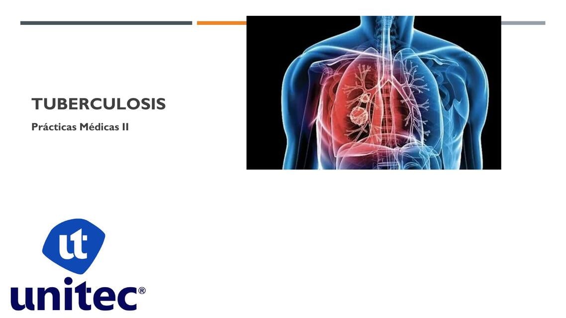 Tuberculosis Practicas 2 | Ariel Faustino González Quintero | uDocz