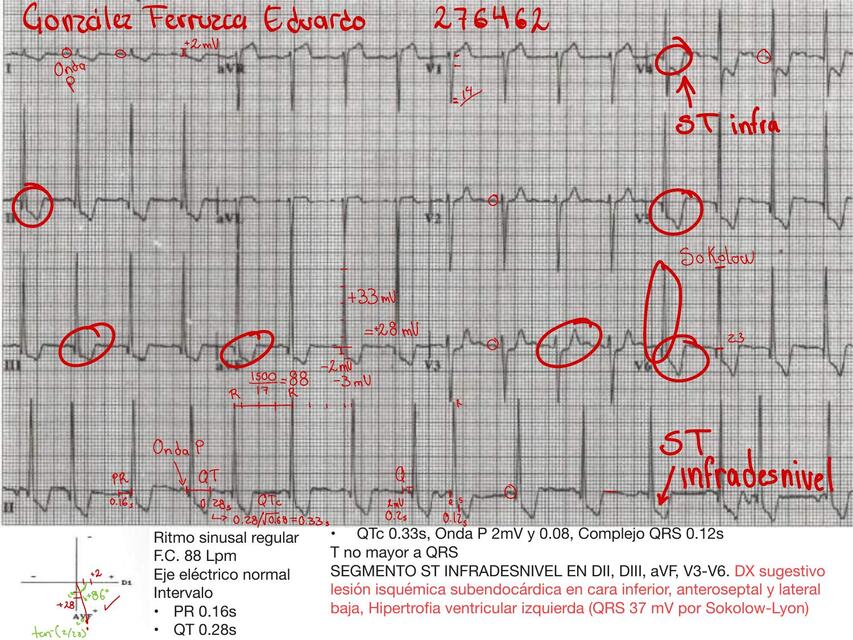 EGF Electros UNO FINAL | Eduardo González Ferruzca | uDocz
