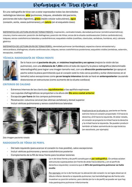 Radiografia Torax normal JT | Jazmin | uDocz