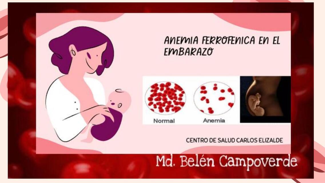 ANEMIA FERROPENICA EN EL EMBARAZO | Antonio | uDocz