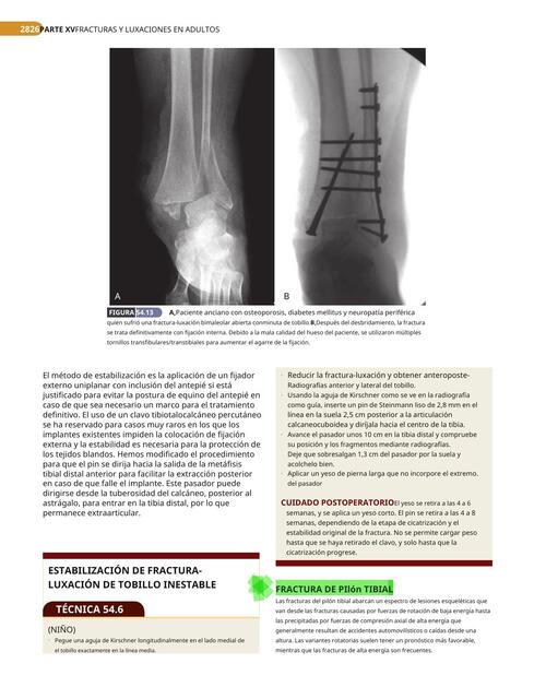 TIBIA CAMPBELL | ANDREA NATALY GUERRA | uDocz