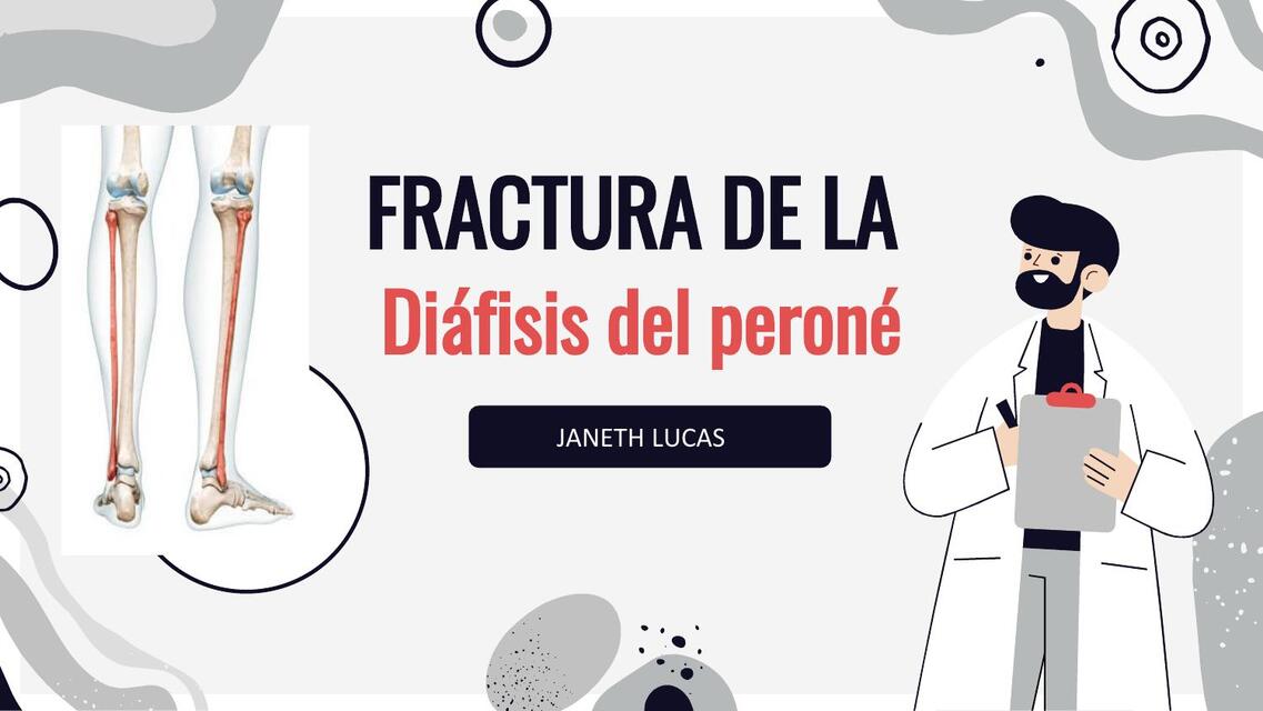 FRACTURA DE LA DIAFISIS DEL PERONE | Janeth Lucas | uDocz