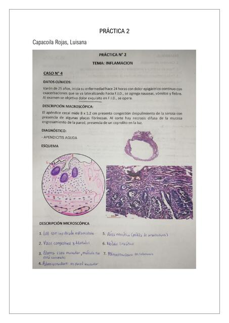 PRÁCTICA 2 - PATOLOGÍA | Luisana Aneth CR | uDocz