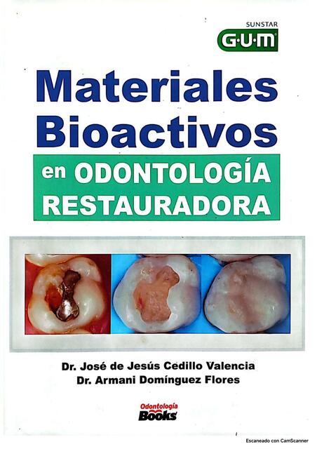 Materiales Bioactivos en Odontología Restauradora | Daniel Rosas | uDocz
