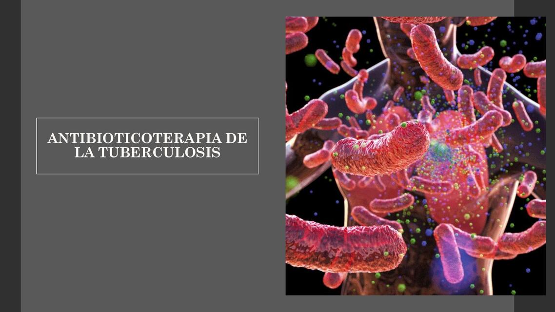 TUBERCULOSIS | MARIA GL | uDocz