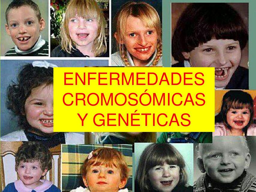 Enfermedades cromosómicas y genéticas | Elizabeth Sarmiento | uDocz