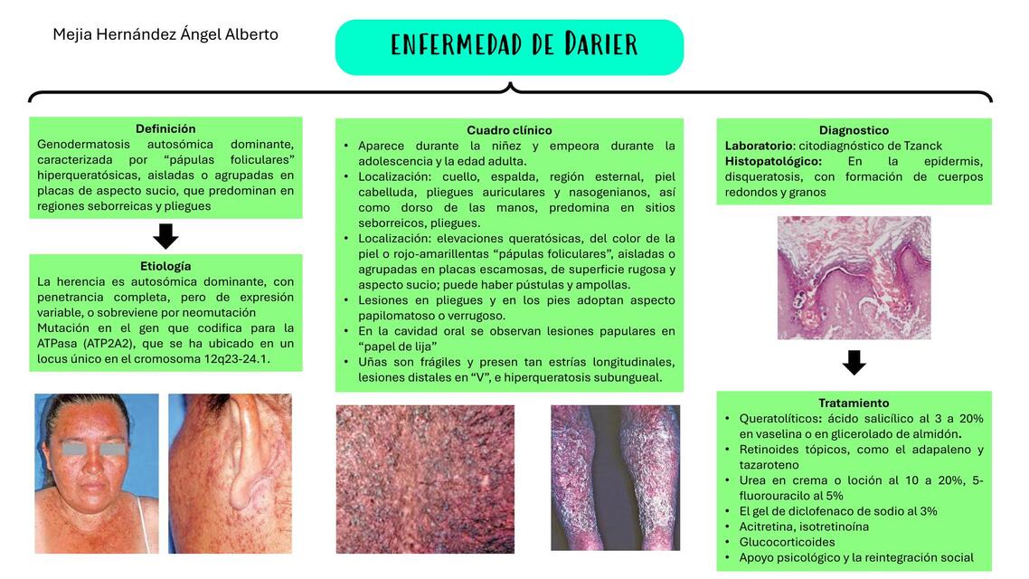 TAREA 36 ENFERMEDAD DE DARIER EHLERS DANLOS | Angel | uDocz