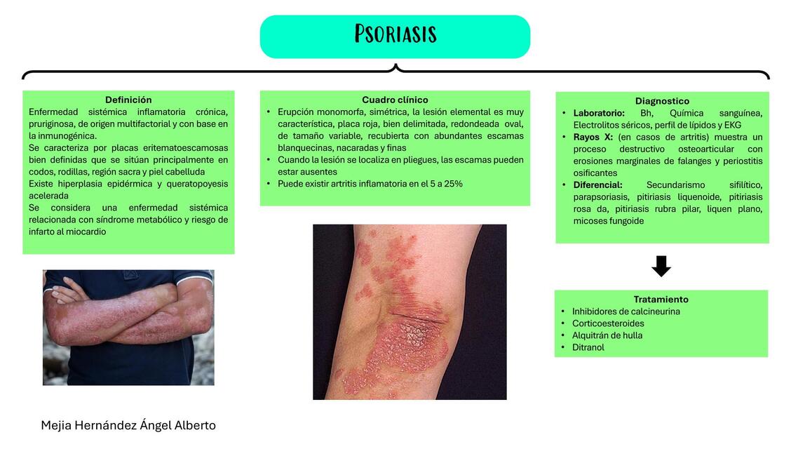 TAREA 46 PSORIASIS | Angel | uDocz