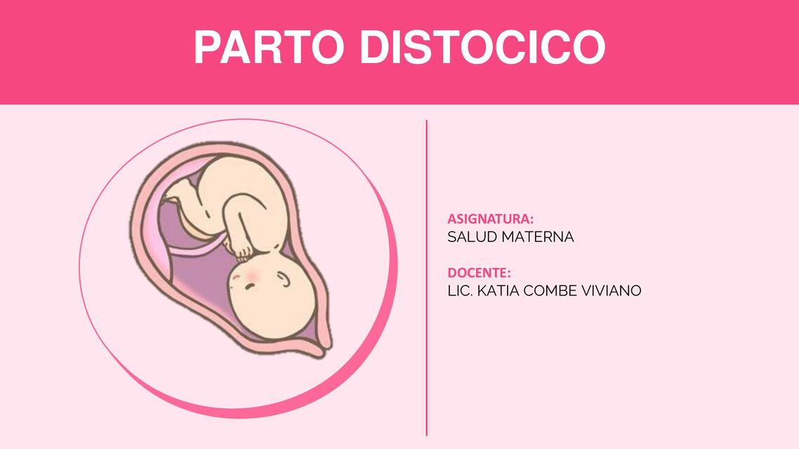 PARTO DISTOCICO CLASE 13 | Katia | uDocz