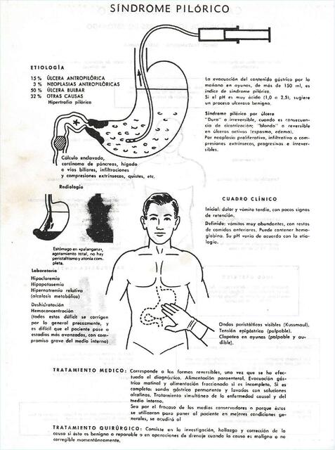 🏥 Síndrome Clínico en Esquema: 🟢 Síndrome Pilorico 🟢 | Dra Odalis ...