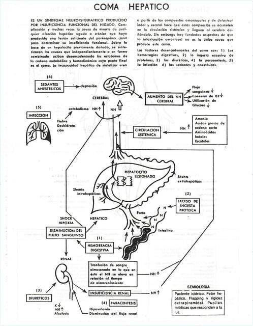 🏥 Síndrome Clínico en Esquema: Coma Hepático 🧡 | Dra Odalis Moreno | uDocz