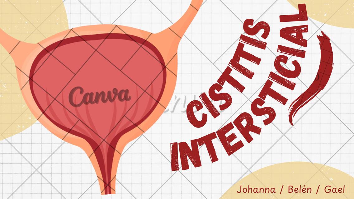 Cistitis Intersticial UROLOGÍA | Yulio Sampieri | uDocz