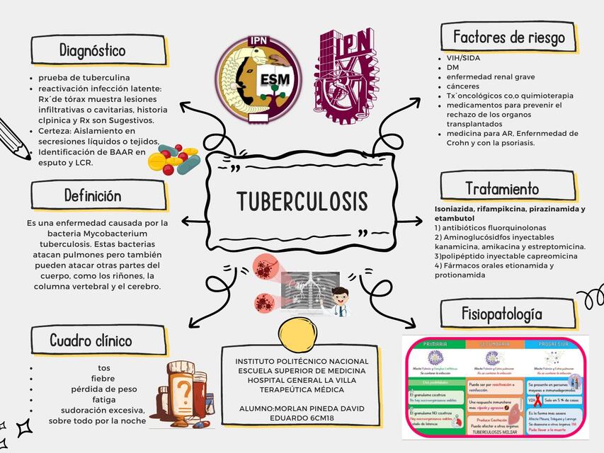 Tuberculosis | David Morlan | uDocz