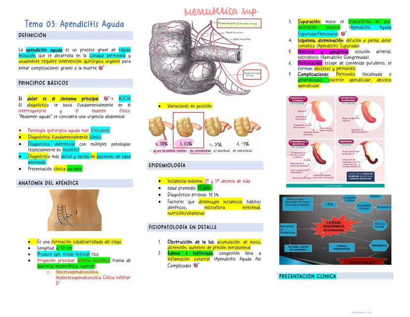 APENDICITIS | Viviana Lopez Miranda | uDocz