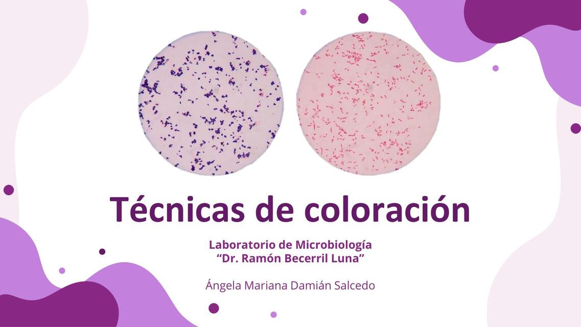 Técnicas de coloración | Angela Mariana Damian Salcedo | uDocz