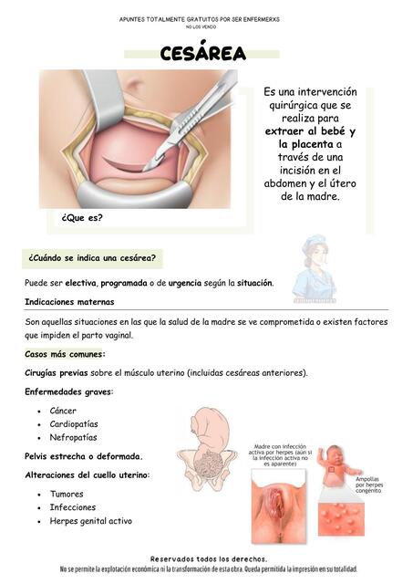 Cesarea SER ENFERMERXS | Ser Enfermerxs | uDocz