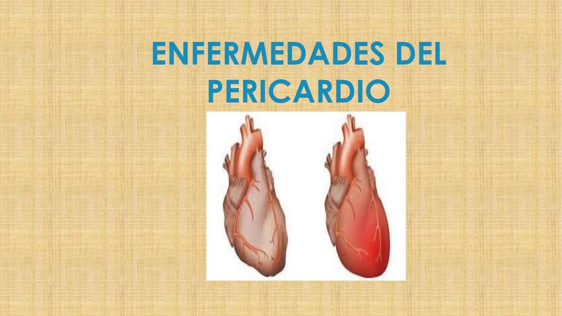 ENFERMEDADES DEL PERICARDIO | CUESTIONARIOS MEDICINA 👨‍⚕️📚 | uDocz