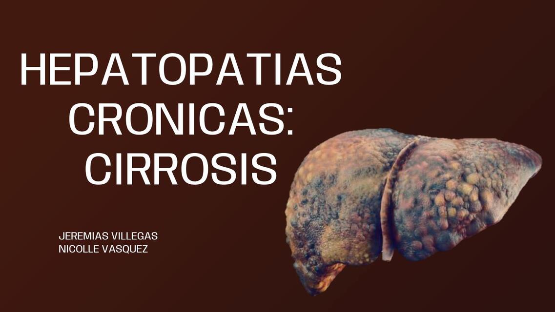 CIRROSIS HEPÁTICA | Ligia Bermello | uDocz