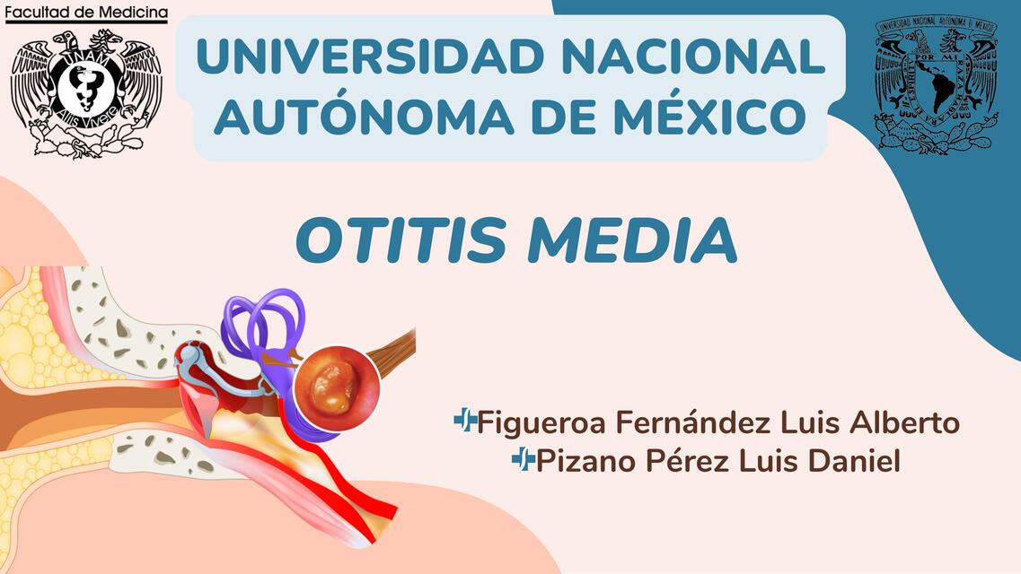 Otitis media | Medicalbert | uDocz