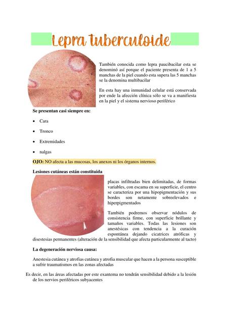 Lepra Tuberculoide | MAYRA VERDEZOTO | uDocz
