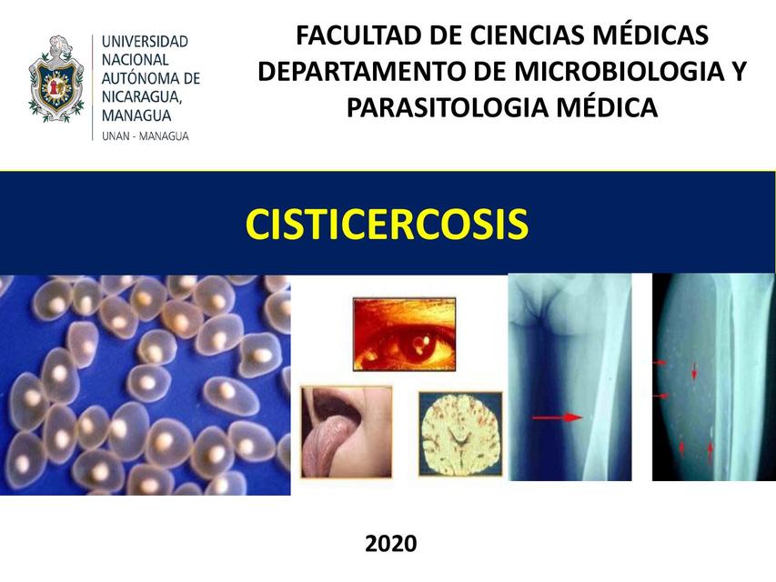 Cisticercosis | Noelia Marcela Diaz Mejia | uDocz