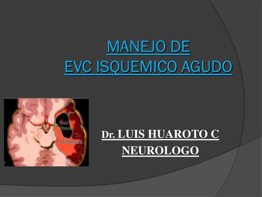 Manejo de EVC Isquémico Agudo | Ahmed Casana | uDocz