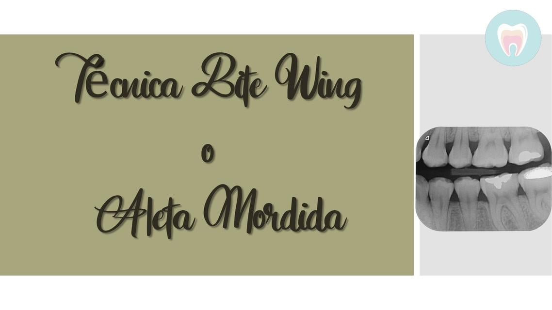Tecnica Bite Wing | Odonto Comunidad | uDocz