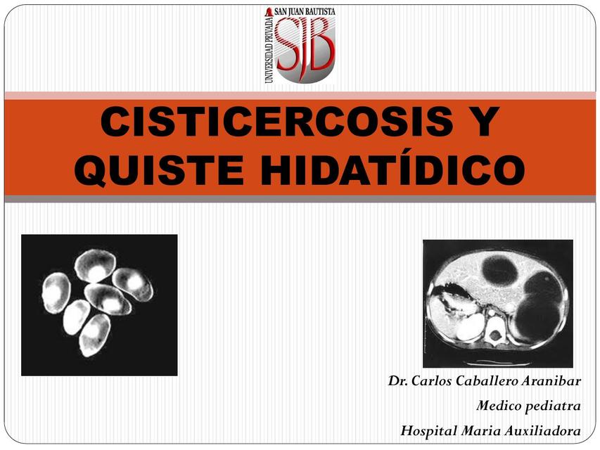 Cisticercosis y Quiste Hidatídico | Ahmed Casana | uDocz