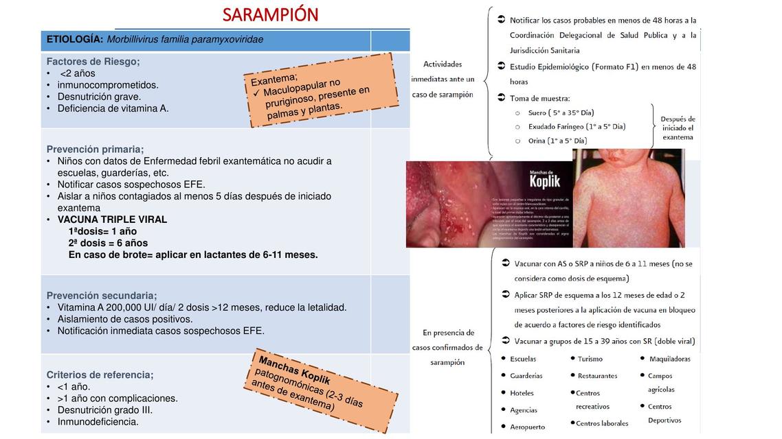 Sarampión | Sarampión | Enfermedades exantemáticas | Apuntes ... Sarampión | Sarampión | Enfermedades exantemáticas | Apuntes ...