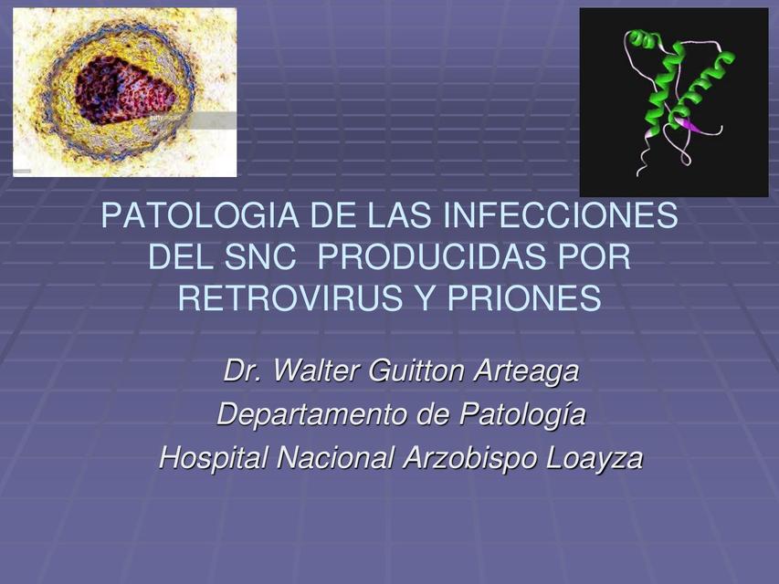 Infecciones del Sistema Nervioso Central por Retrovirus y Priones ...