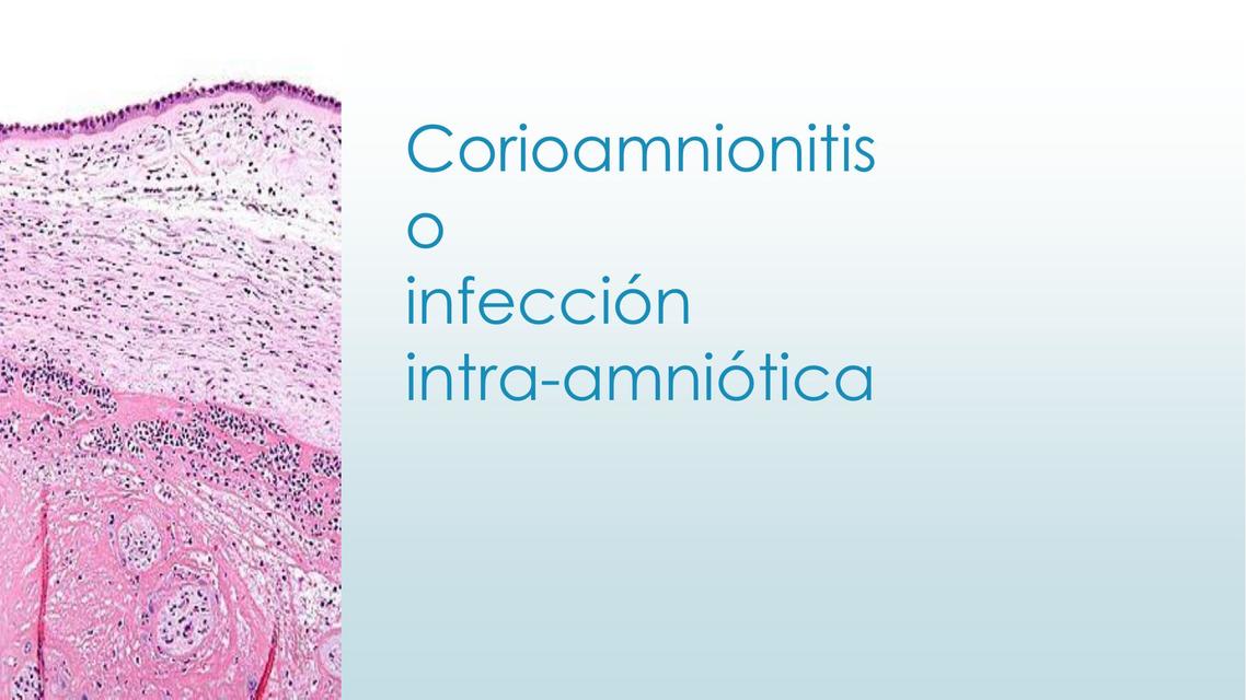 Corioamnionitis o infección intra amniótica Autoguardado | Ingrid Johan ...