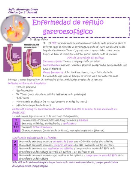 Enfermedad de reflujo gastroesofágico