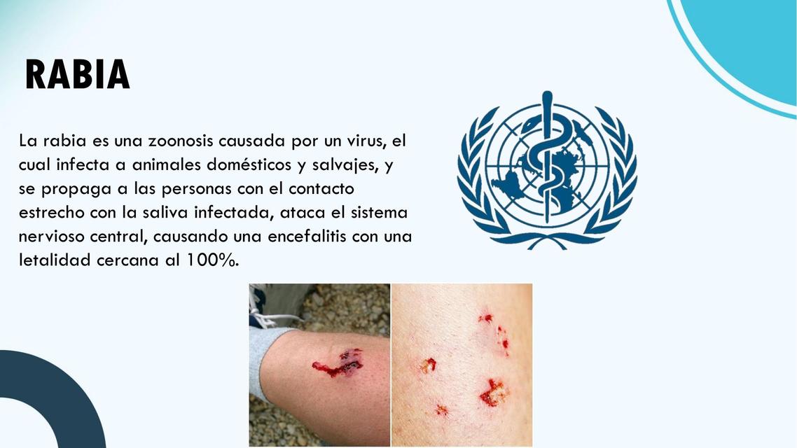 Rabia | Raúl B Picazo | uDocz