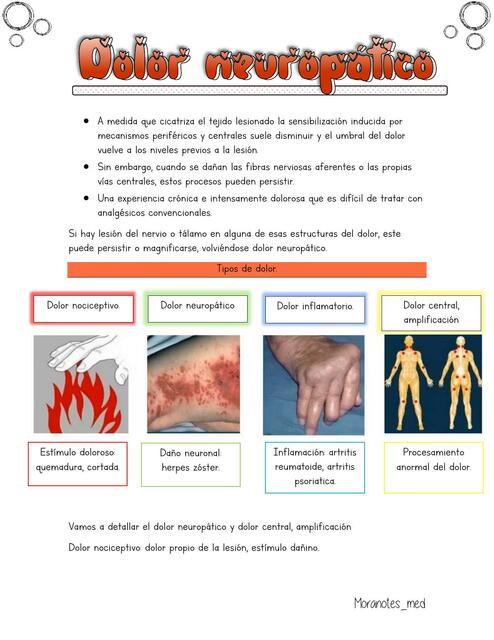 Dolor neuropático | Moranotes_med | uDocz