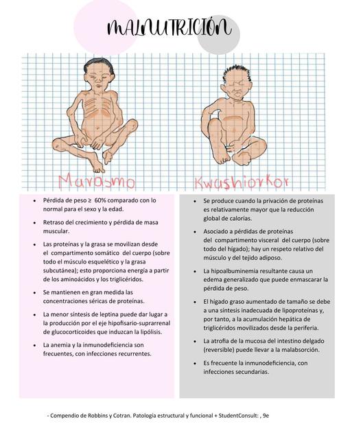 Resúmenes de Marasmo | Descarga apuntes de Marasmo