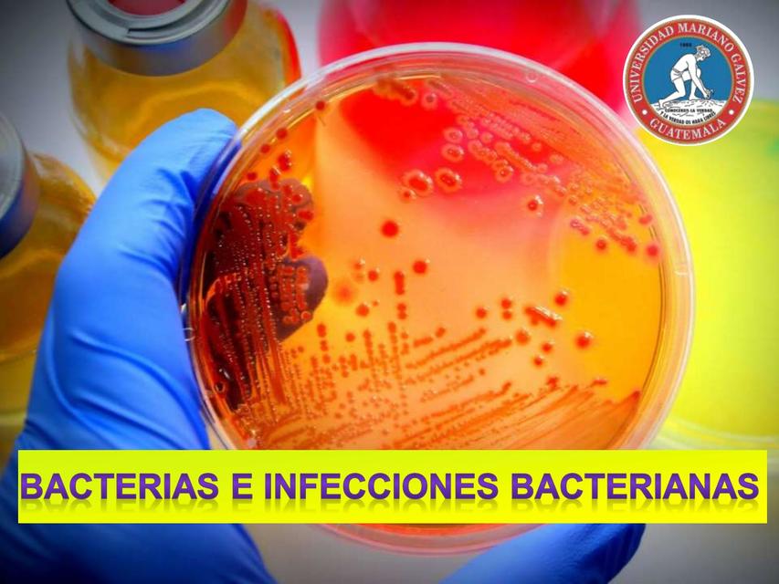 Bacterias e Infecciones Bacterianas | Sara Vicente | uDocz