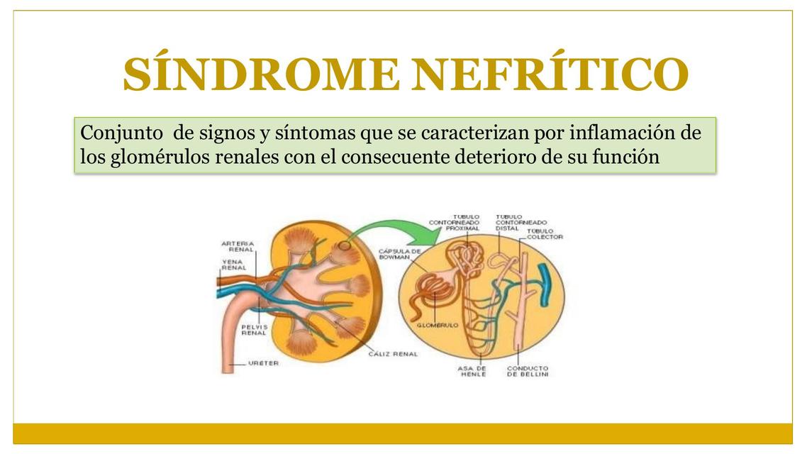 Síndrome nefrítico | Síndrome nefrítico | Anatomía | uDocz