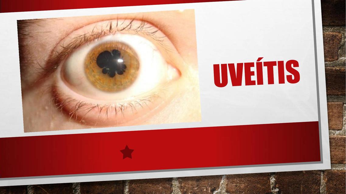 Resúmenes de Uveitis | Descarga apuntes de Uveitis