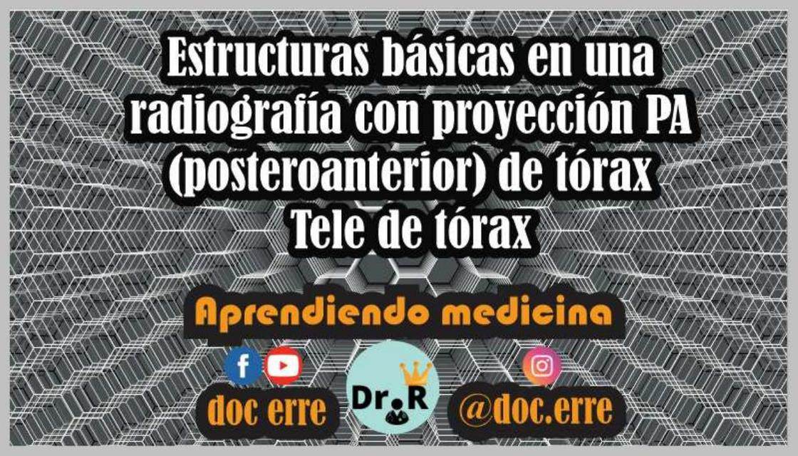 Estructuras básicas en una radiología de tórax | Dr erre | uDocz