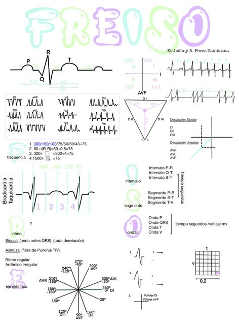 Electrocardiograma | Esthefany Pérez Zambrana | uDocz