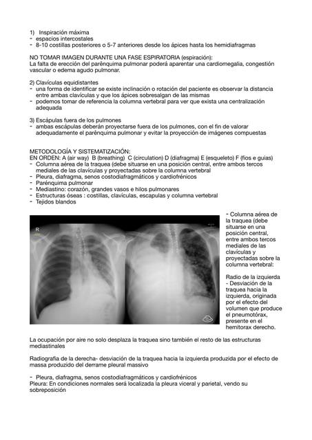 Rx tórax | Busca y descarga apuntes gratis | uDocz