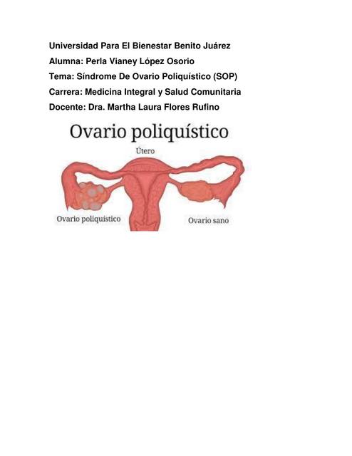 Síndrome De Ovario Poliquístico (SOP) | Pati Osorio | uDocz