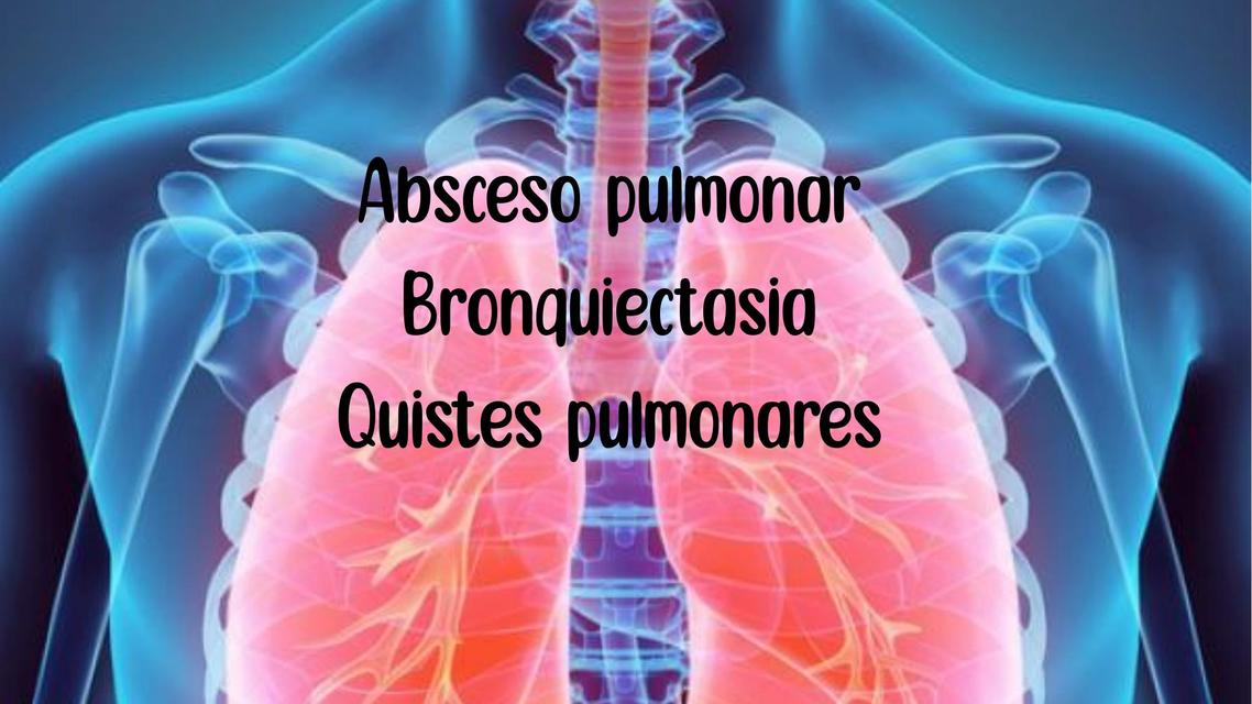 Absceso Pulmonar | Dennis Sanchez | uDocz