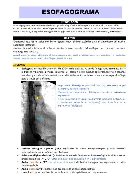Esofagograma | Radiología | Esófago | uDocz