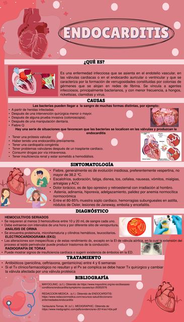 Flashcards de Endocarditis | Por Larizza Azeneth Ortiz Vargas | uDocz