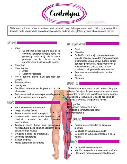 Ciatalgia | Lizeth Vega Muratalla | uDocz