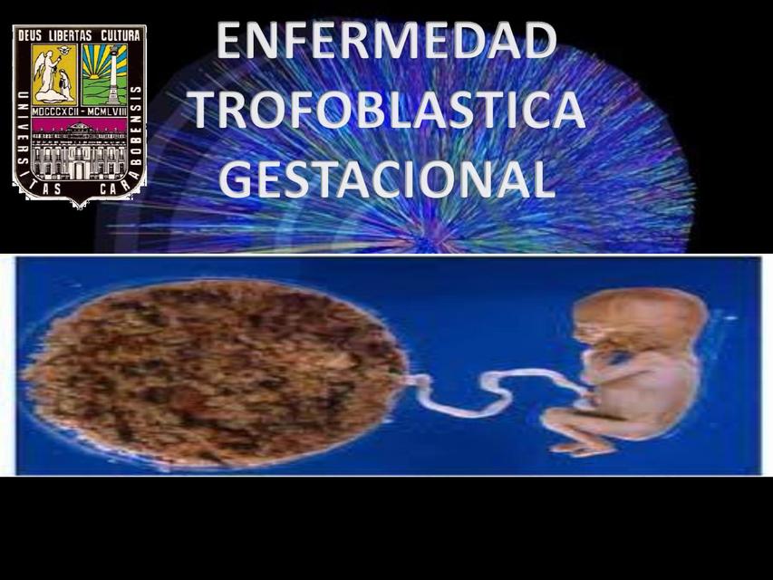 Enfermedad trofoblástica gestacional | Leonela Cordova Vena | uDocz