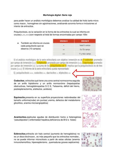 Resúmenes de Poiquilocitosis | Descarga apuntes de Poiquilocitosis