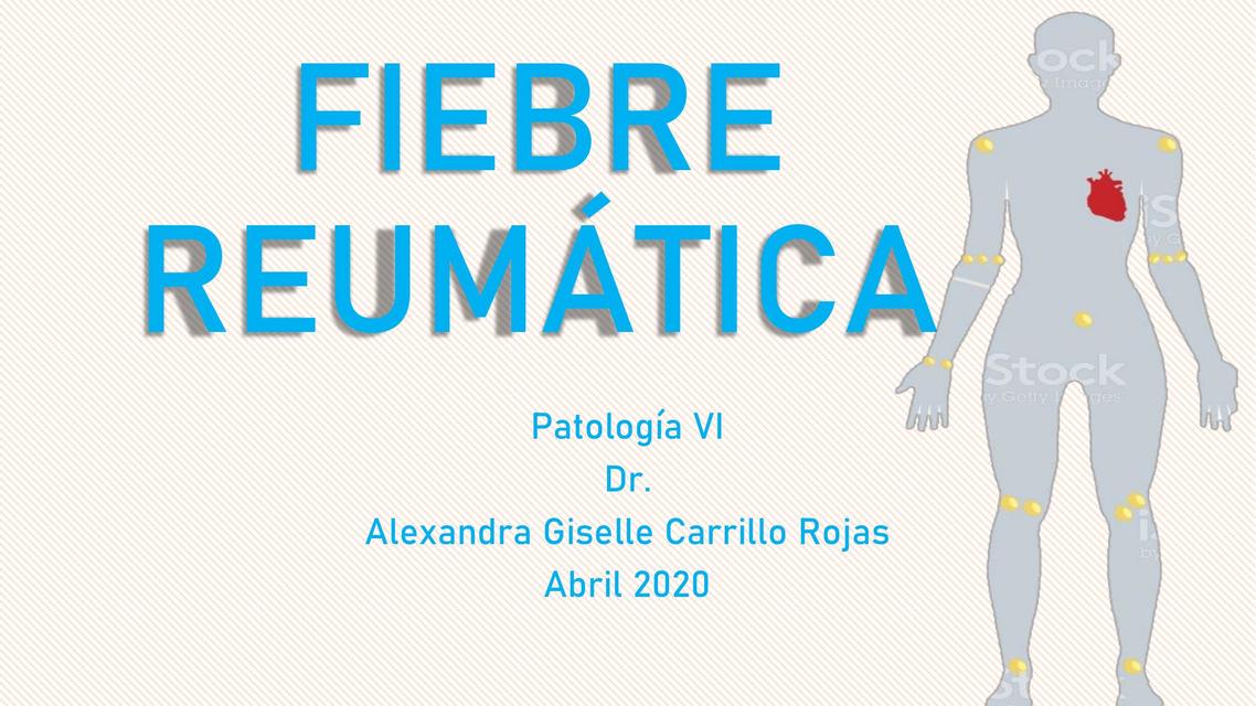 Fiebre Reumática | Alexandra Carrillo | uDocz