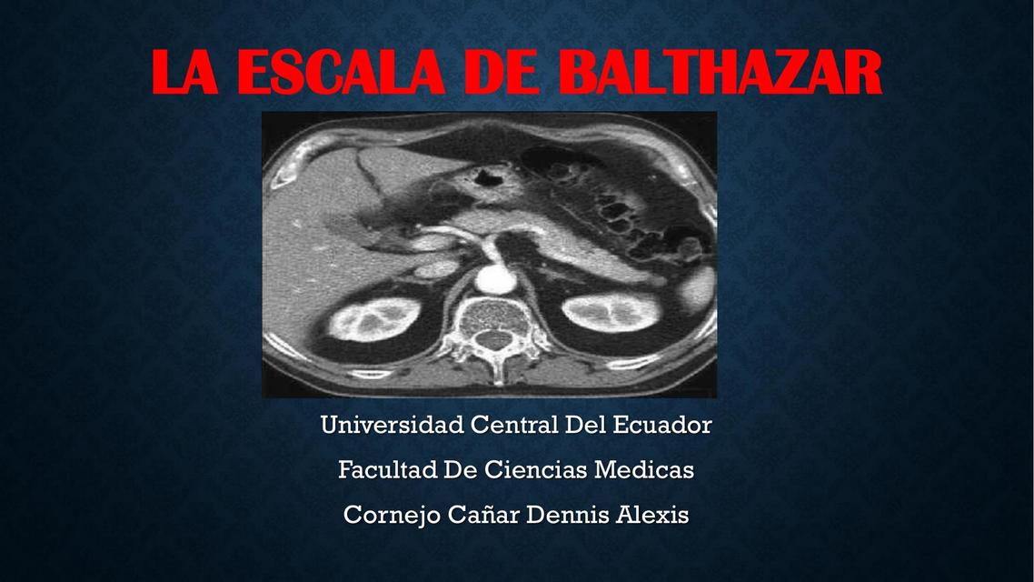 La Escala de Balthazar | Dennys Cornejo | uDocz La Escala de Balthazar | Dennys Cornejo | uDocz